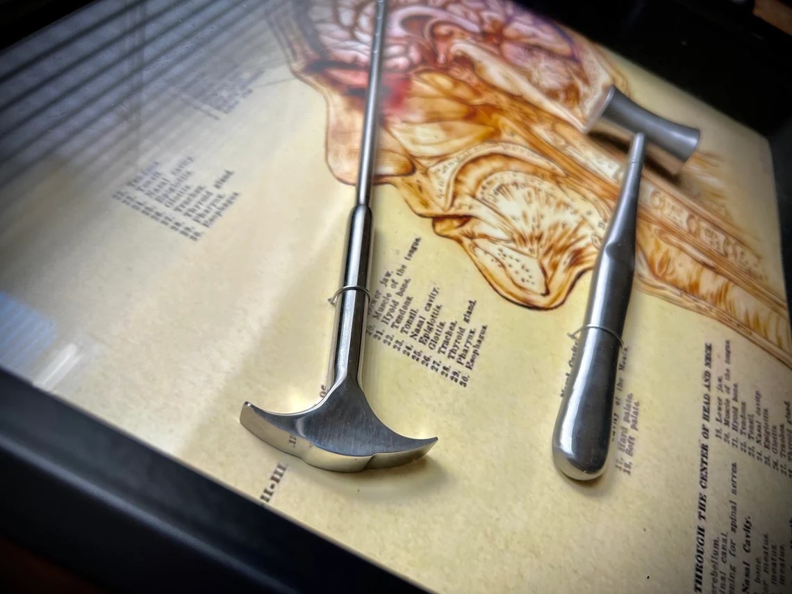 Lobotomy Shadowbox Display Large - Matt's Curio Cabinet